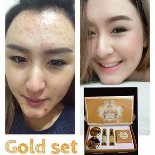 #1 Thailand Skin Whitening Products