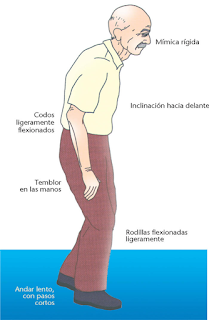 ParkinsonRHF