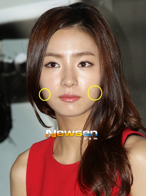 Did Shin Se Kyung really only get scar removal surgery?