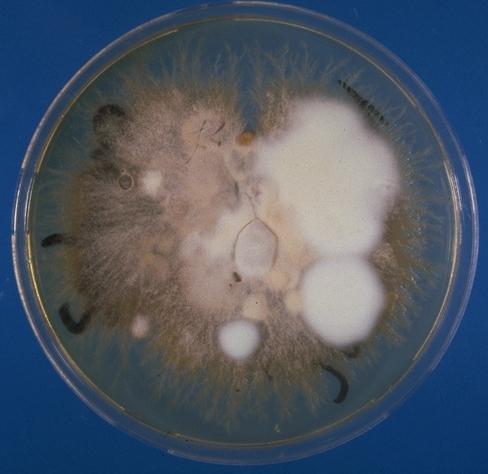 Microbiología y Epidemiología: Epidermophyton floccosum