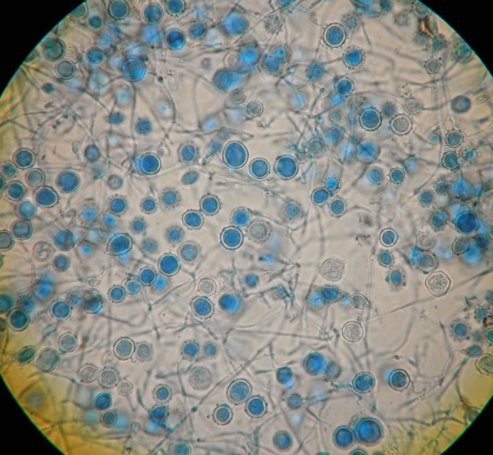 ATLAS MICOLOGIA: CONIDIOBOLUS CORONATUS