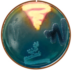 [Microbiology] Hektoen Enteric Agar | Free Medical Atlas