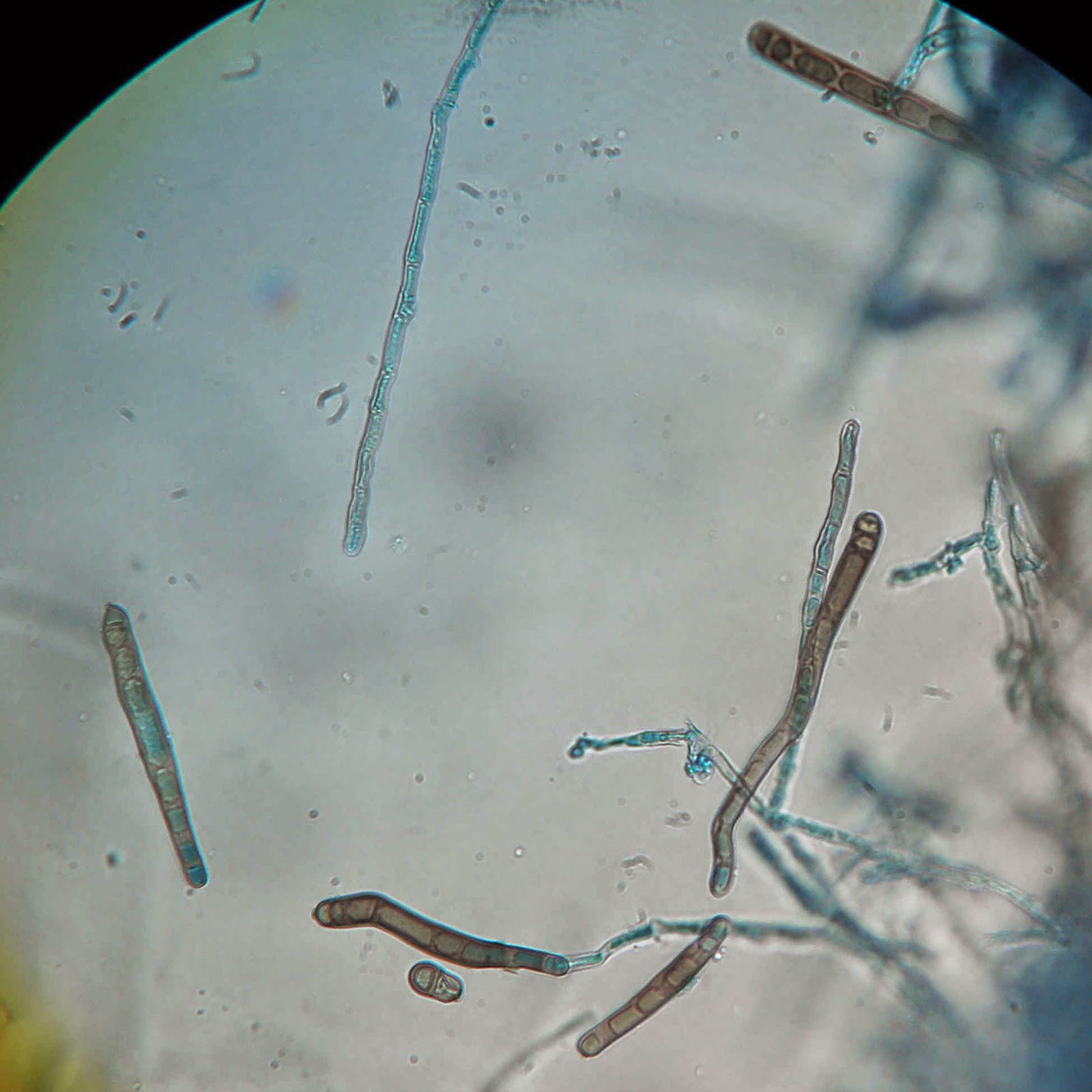 ATLAS MICOLOGIA: EXSEROHILUM ROSTRATUM