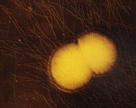 TEMA V MICROBIOLOGIA