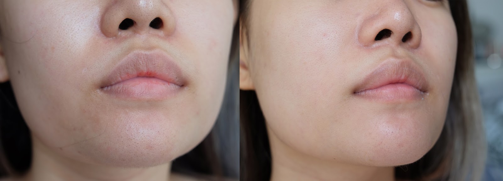 How to Get Baby Skin Face - Stella Lee ☆ Indonesia Beauty and Travel Blog