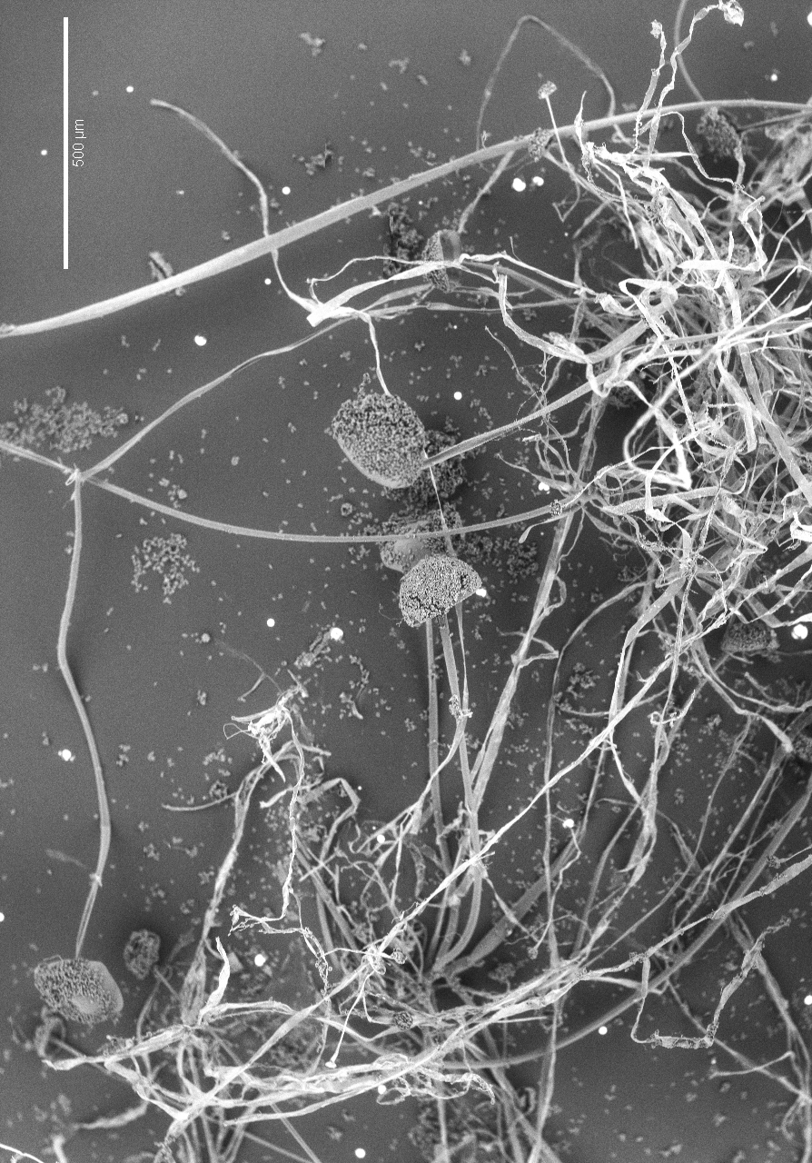 Scanning Electron Microscope Blog