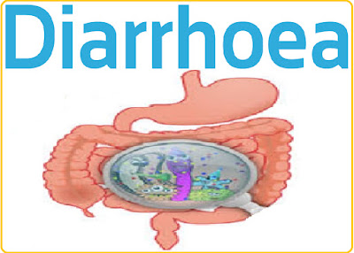 What is Diarrhea? - Diarrhea Definition and Classifications in Details ...
