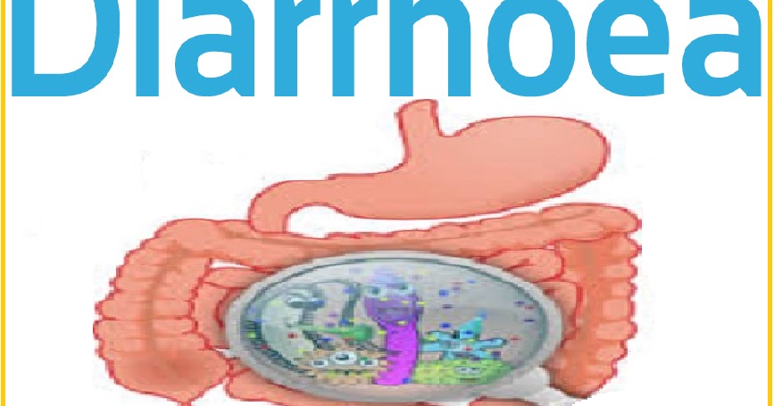 What is Diarrhea? - Diarrhea Definition and Classifications in Details ...