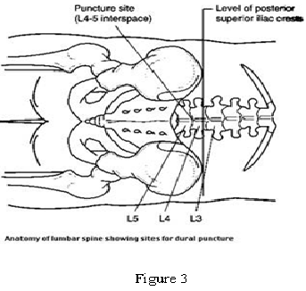Update On Current Medicine: Lumbar Puncture