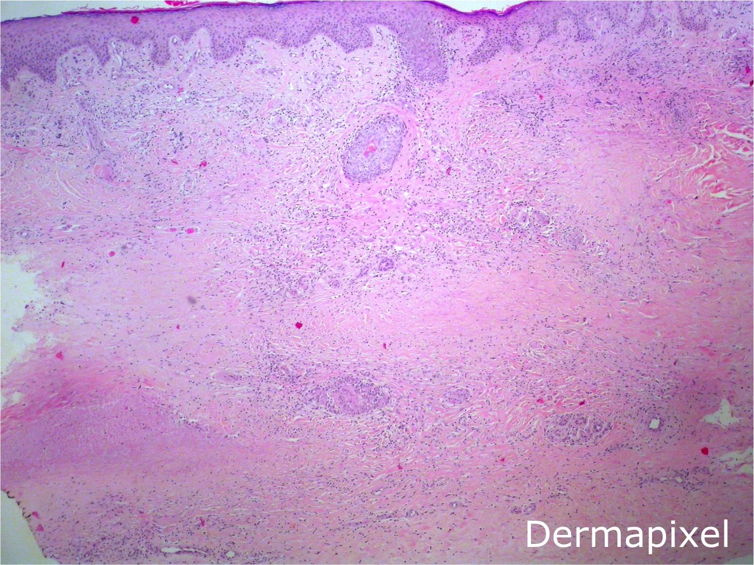 Dermapixel: enero 2018