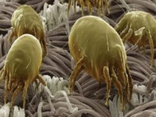 डस्ट माइट से एलर्जी क्यों क्या और कैसे – Dust Mites and allergy ...