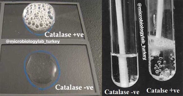 CATALASE TEST PROCEDURE - Microbiology Lab Notes