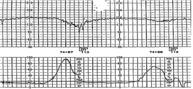 MBBS Medicine (Humanity First): Assessment of Fetal Well-being