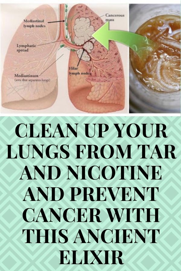 Clean Up Your Lungs From Tar And Nicotine And Prevent Cancer With This ...