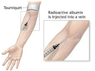 Kesehatan : Injeksi Intra Vena (IV)