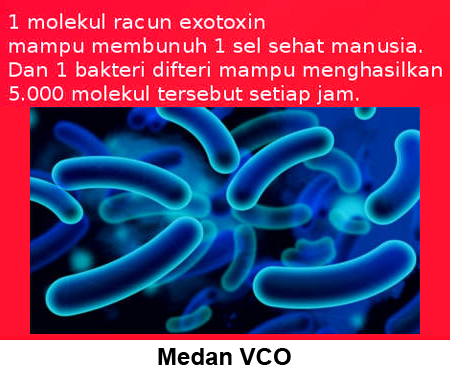 Bakteri Penyebab Wabah Difteri ~ Medan VCO