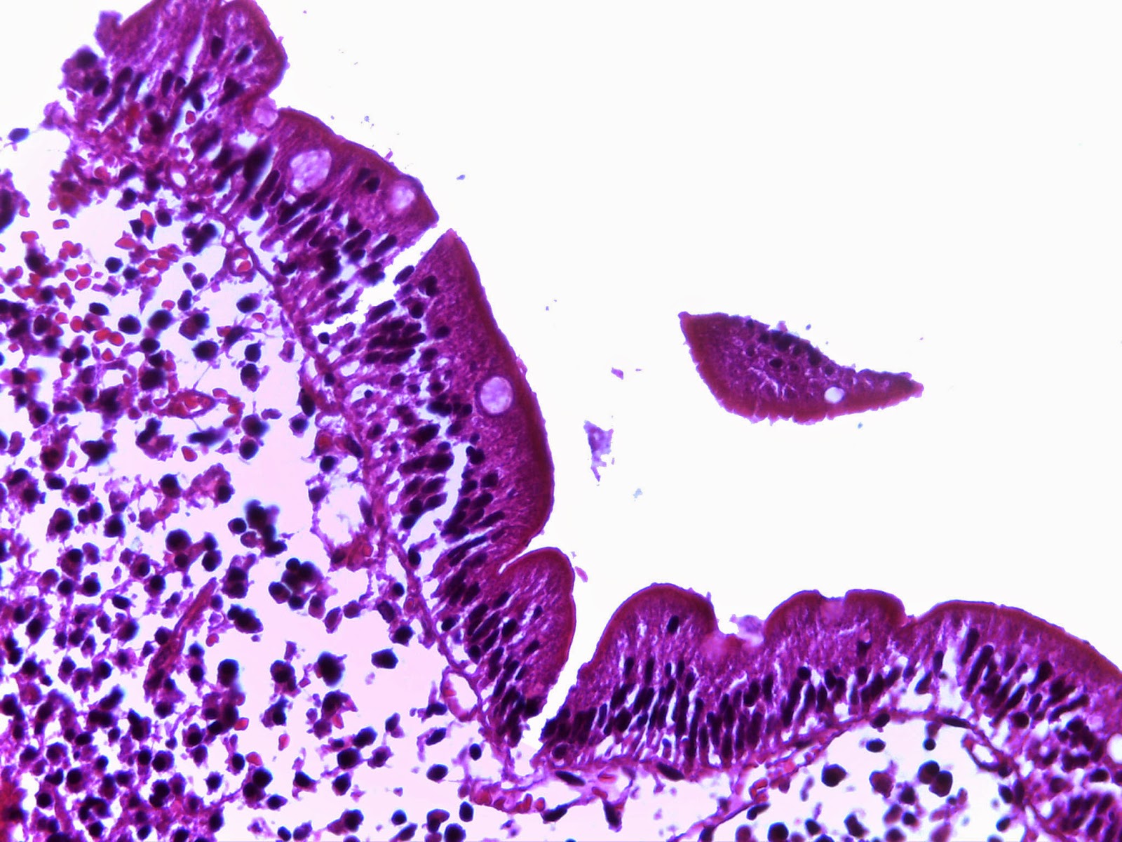 GASTROINTESTINAL AND LIVER HISTOLOGY PATHOLOGY ATLAS: DUODENUM: VILLOUS ...