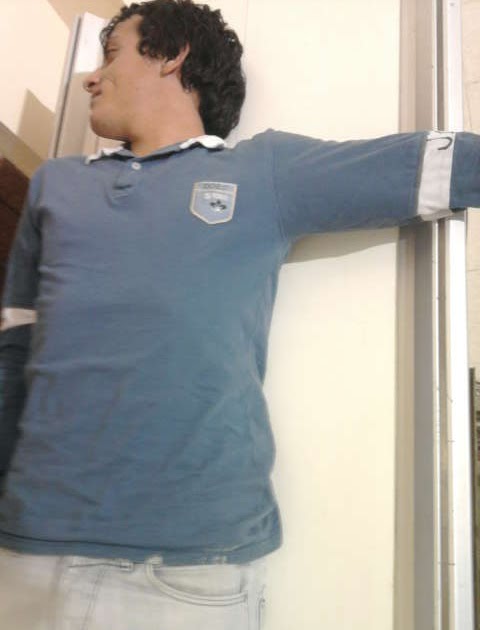 Radiología: Articulación del Hombro. Proyección Axial Inferosuperior ...