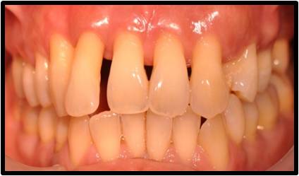 Blog Rasmi Bahagian Kesihatan Pergigian Negeri Perlis: Perkhidmatan ...