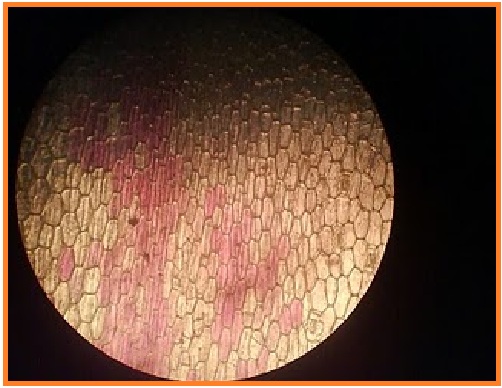 OSMOSIS - KRENASI - PLASMOLISIS - Biology Page