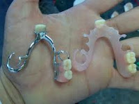 Atelier Dental, Dr Alfredo Aleman Neto, Reabilitação Oral no Bessa ...