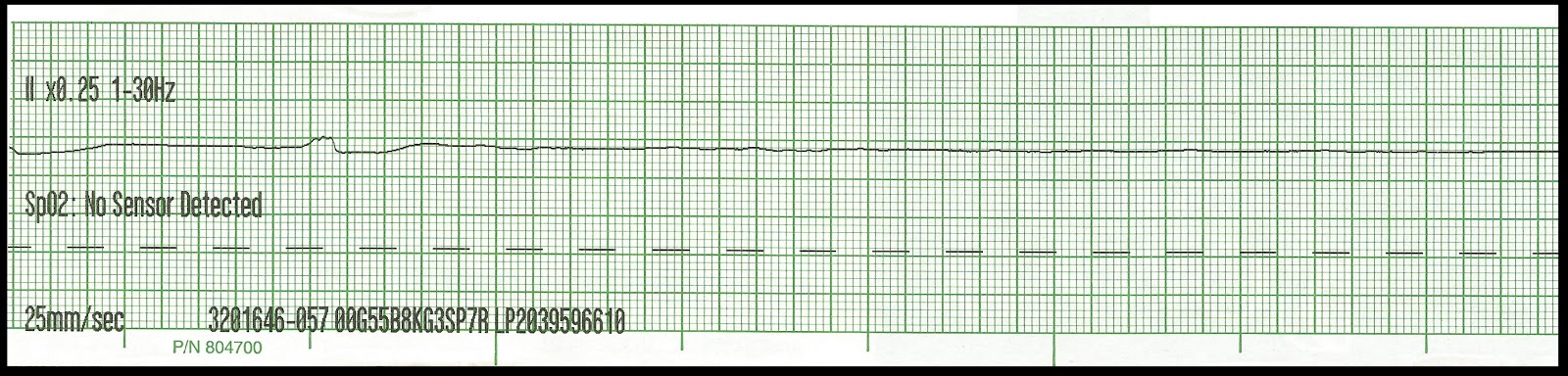 Code Blue: Shop till you drop