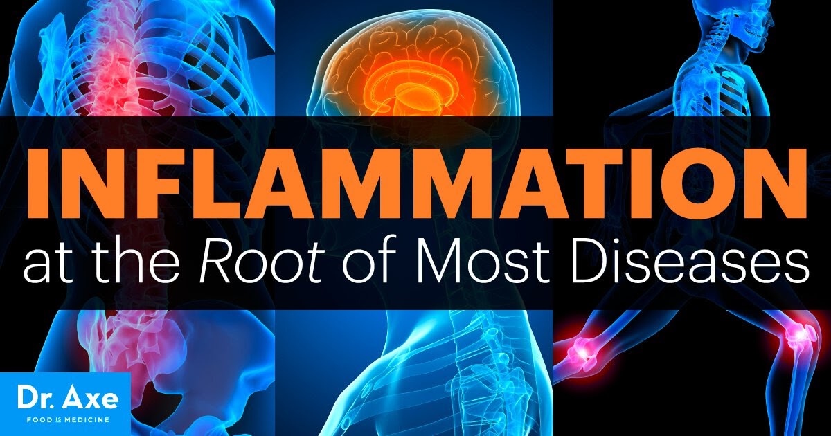 [PPT] INFLAMASI & ANTIINFLAMASI (STEROID & NONSTEROID-AINS/NSAID)