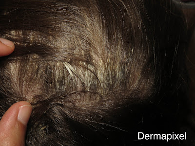 Dermapixel: abril 2018