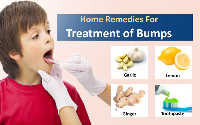 Easy and Effective Treatment of Bumps at Home | Arbkan
