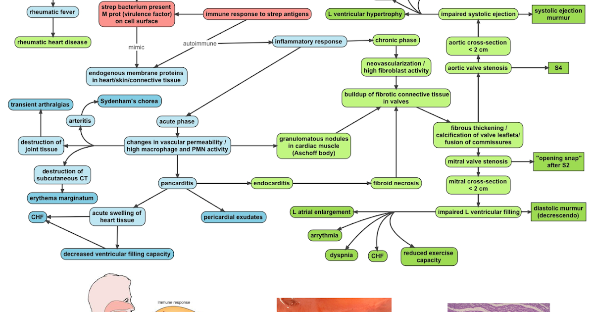 Medical Concept maps : Cardiovasular System