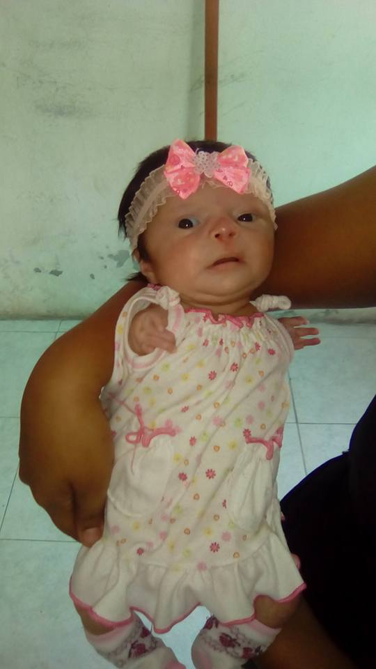 ACTUALIDAD NACIONAL : Niña Mariquiteña Posee Síndrome de Focomelia y ...