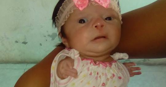 ACTUALIDAD NACIONAL : Niña Mariquiteña Posee Síndrome de Focomelia y ...