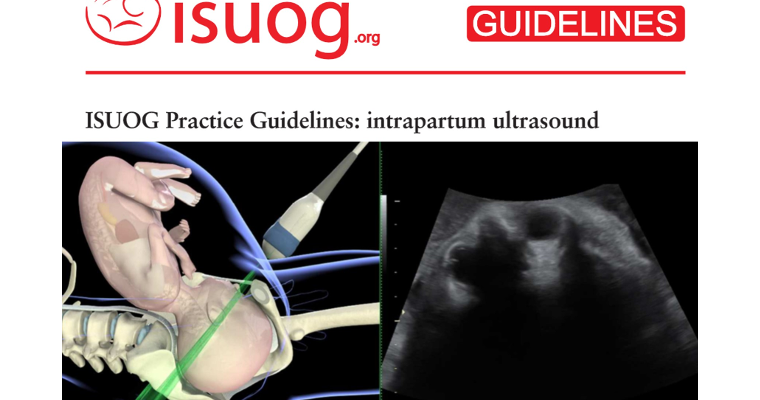 Ob/Gyn Updated : ISUOG Practice Guidelines: Intrapartum Ultrasound