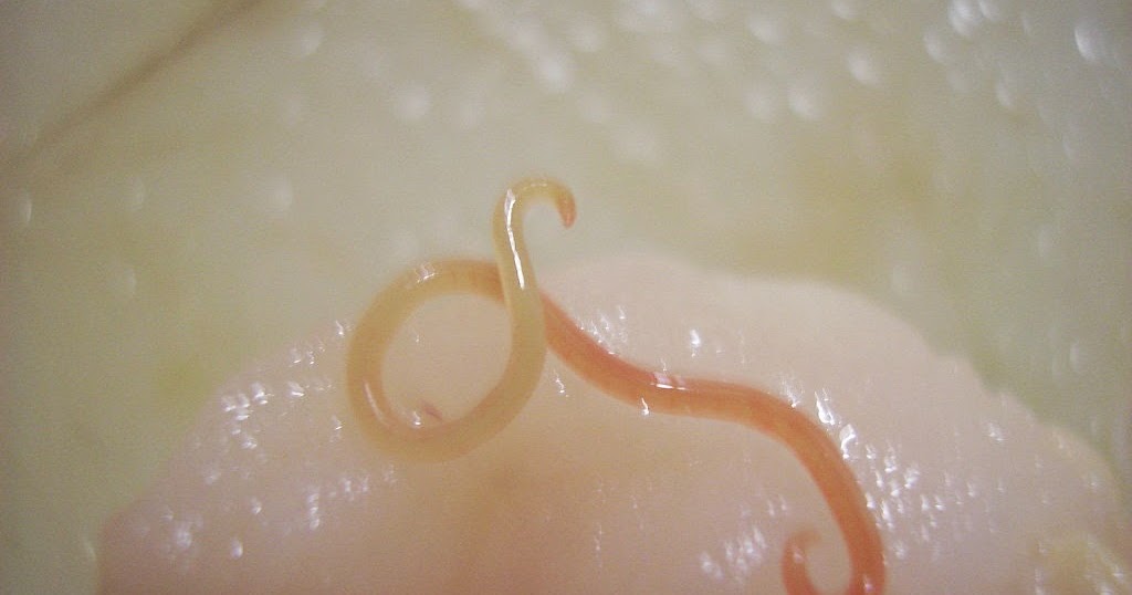 El blog de TufarmaOnline: ANISAKIS