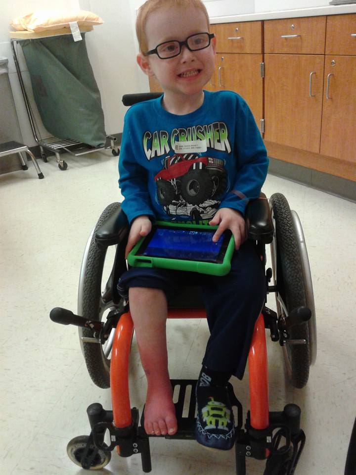 how to deal with one leg shorter than the other sacraments