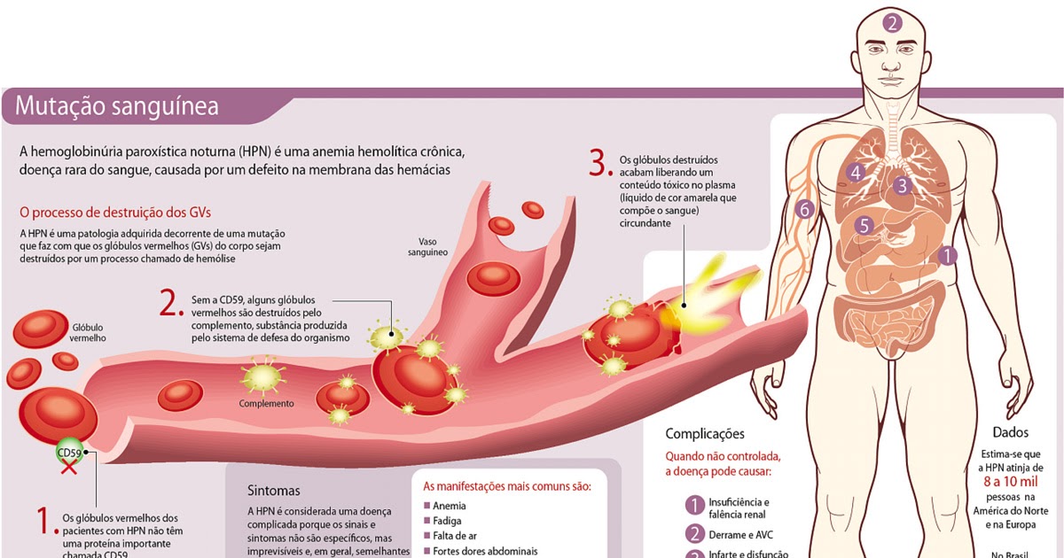 Hemoglobinúria Paroxística Noturna