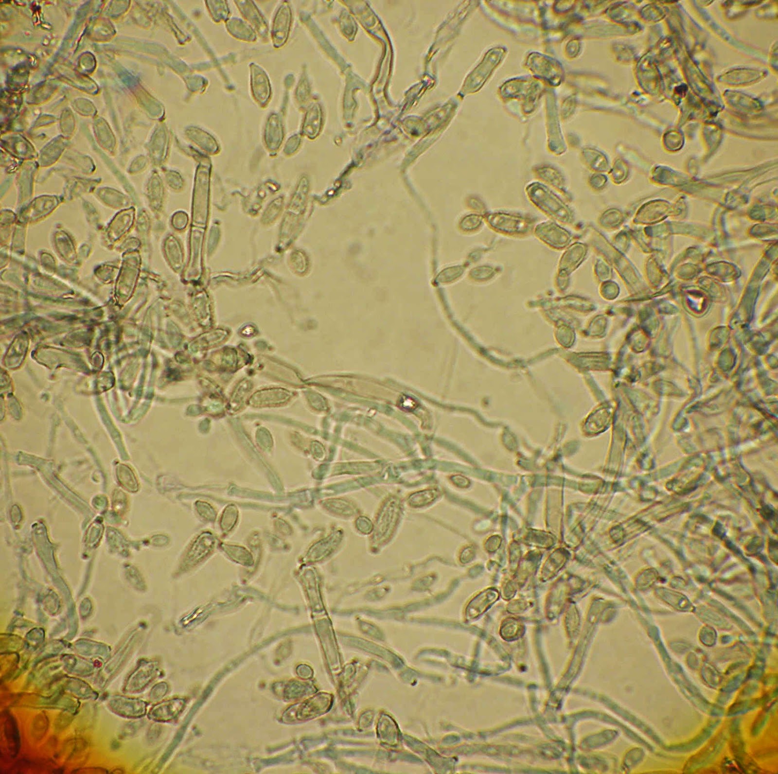 ATLAS MICOLOGIA: CLADOSPORIUM HERBARUM