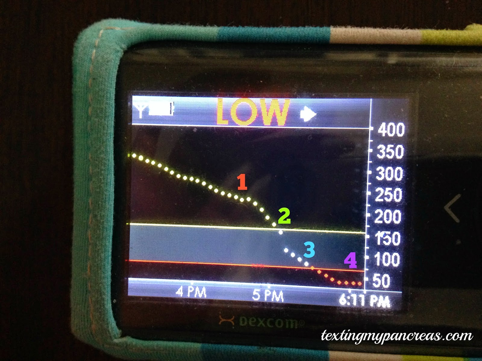 Unaquescribe: Anatomy of a Dexcom Graph.