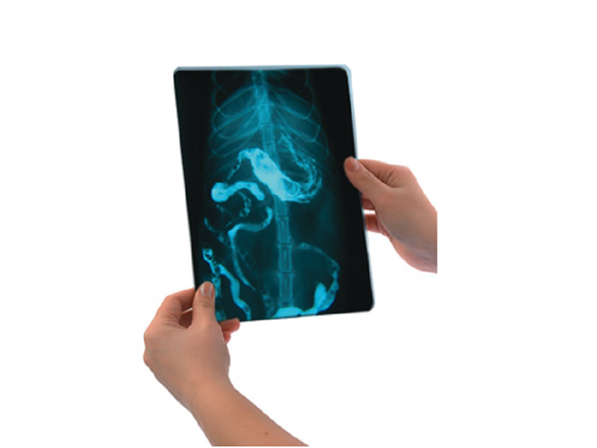 PREPARACIÓN DEL PACIENTE PARA: Exploración con Contraste Yodado.