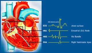 Dr Han Naung @ Henry Han : Electrophysiology and Heart Rhythm : Basics ...