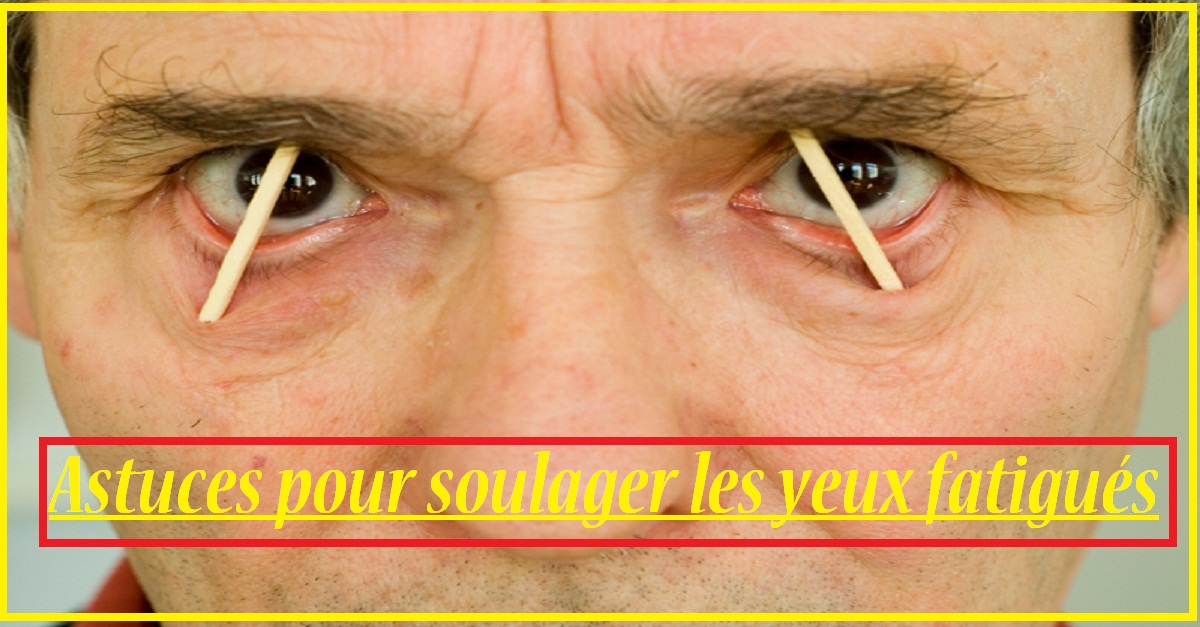 Yeux fatigués? 5 astuces pour soulager les yeux fatigués ~ Sport et Santé