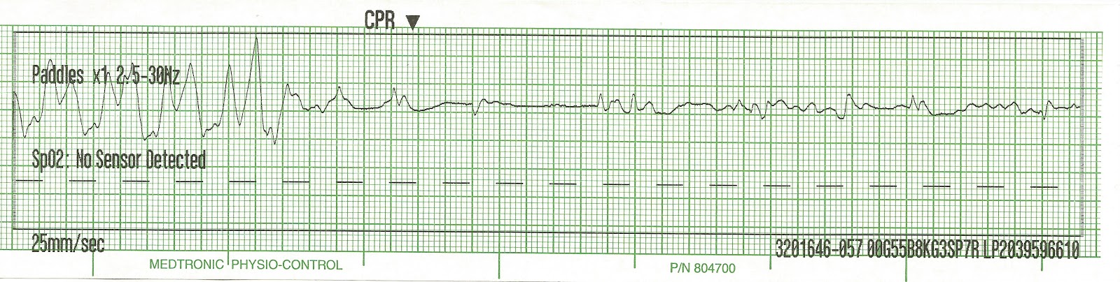 Float Nurse: Code Blue: Cafe Coronary