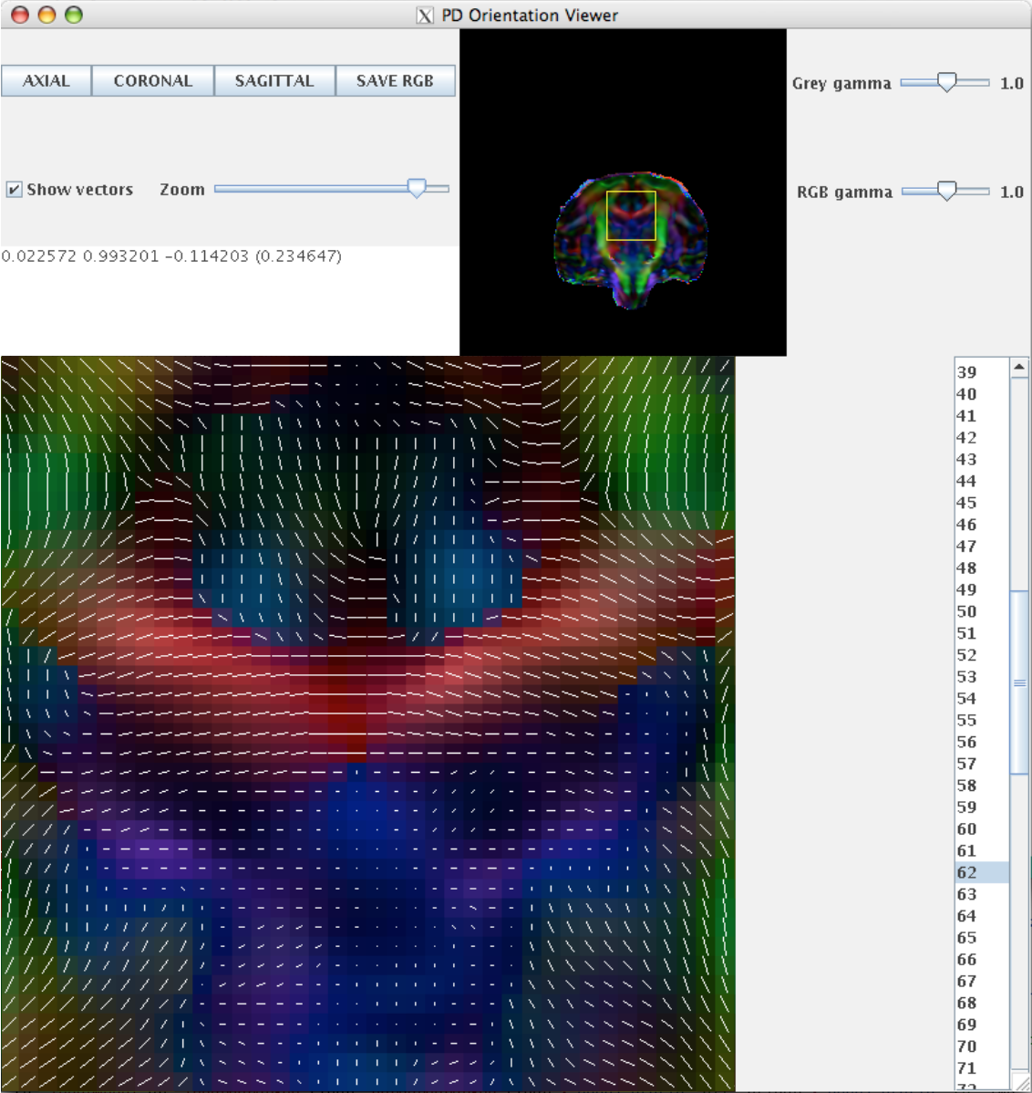 DTI Quality Control - Part 2: Tensor fitting | Diffusion Imaging; Introduction, tutorials and ...