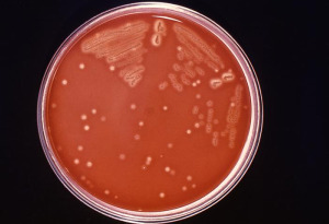 Big Bad Bugs and Infectious Diseases: Week 2 Laboratory: Blood Cultures