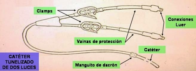 TÉCNICA ADECUADA PARA EL CUIDADO DEL CATÉTER VENOSO CENTRAL: MATERIAL ...