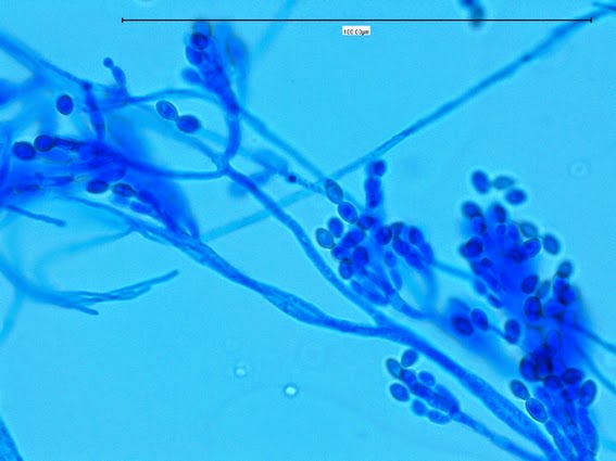 Fun With Microbiology (What's Buggin' You?): Scopulariopsis brumptii