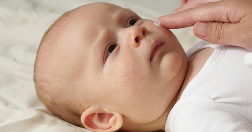 Infantigo Treatment ~ Infantigo - Pictures, Contagious, Causes ...