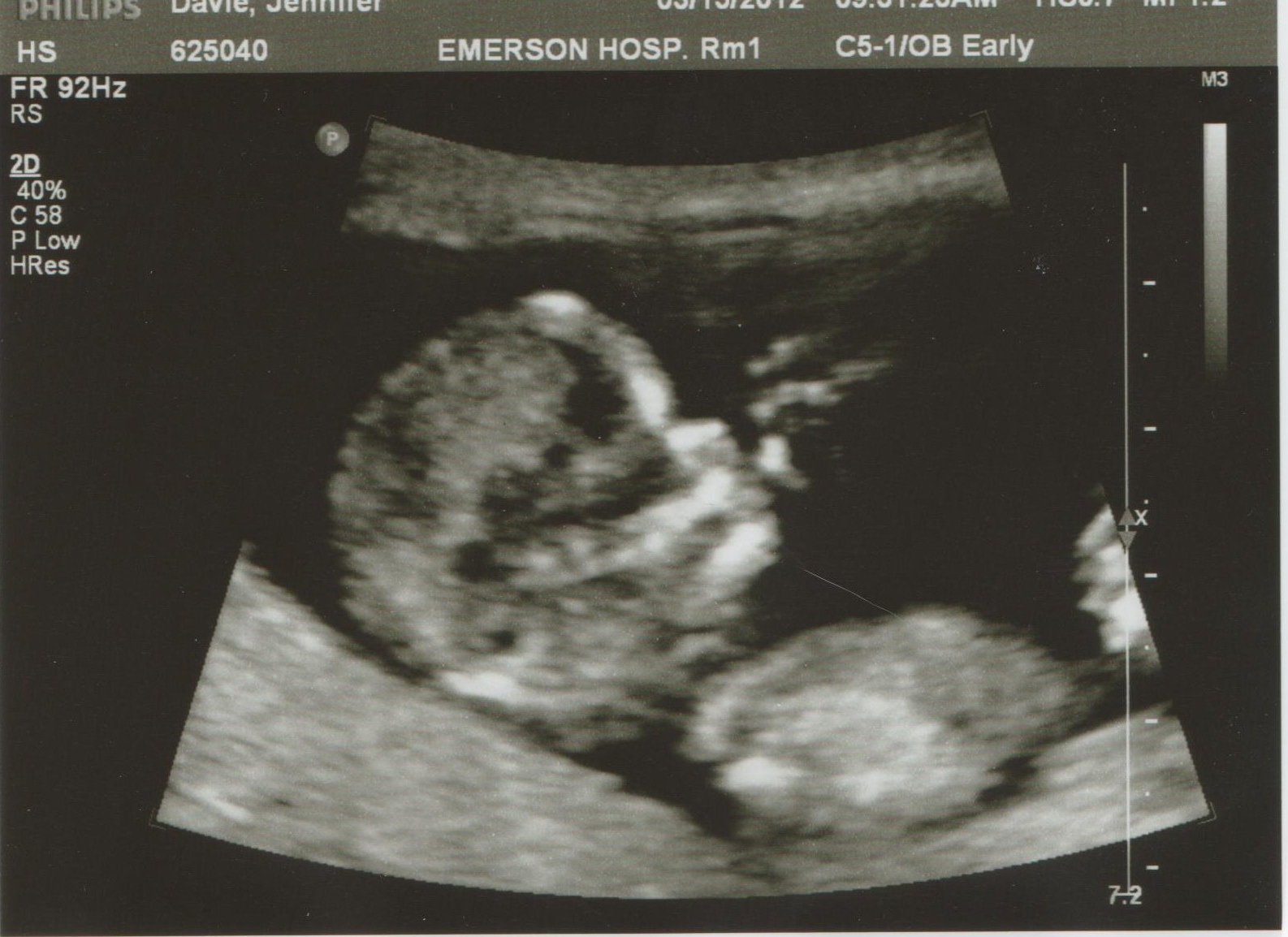 Little Baby Davie: 12 Weeks - End of the First Trimester!! (March 15-21 ...