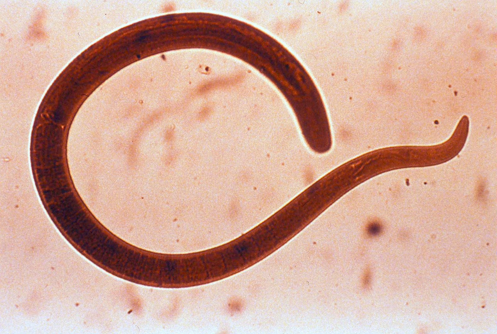 History of Intestinal Worms