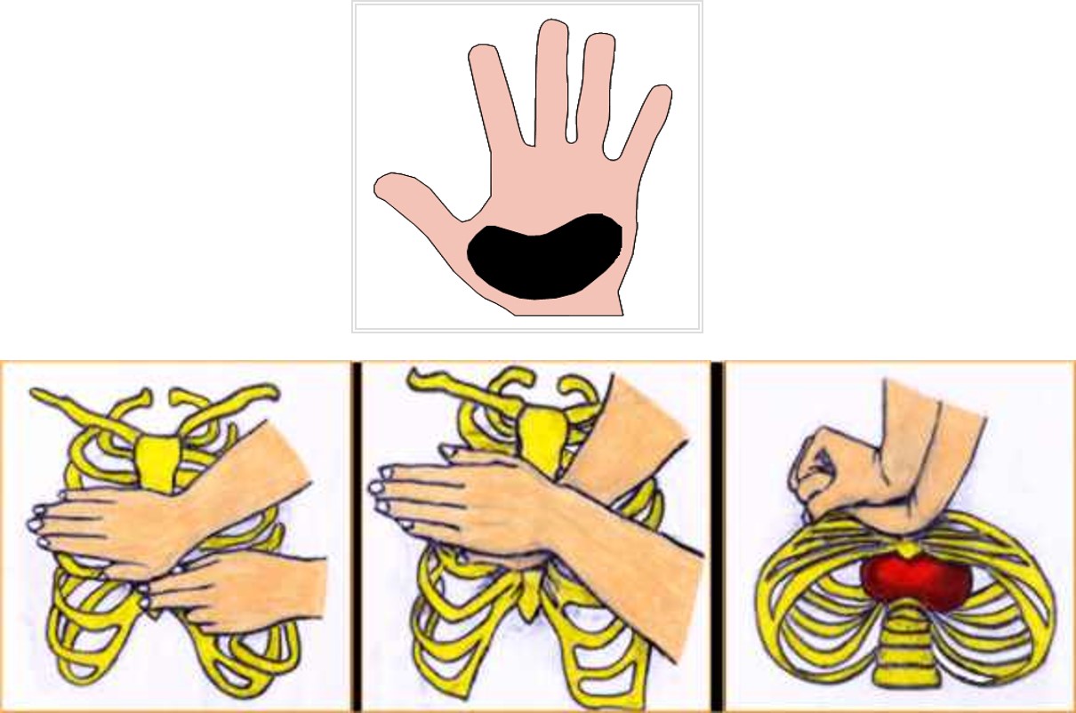 ENFERMERIA: REANIMACION CARDIOPULMONAR